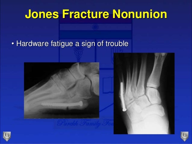 Lecture 16 parekh jones