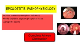 Lecture_17,21 Common Respiratory and cardiac diseases in children.pptx