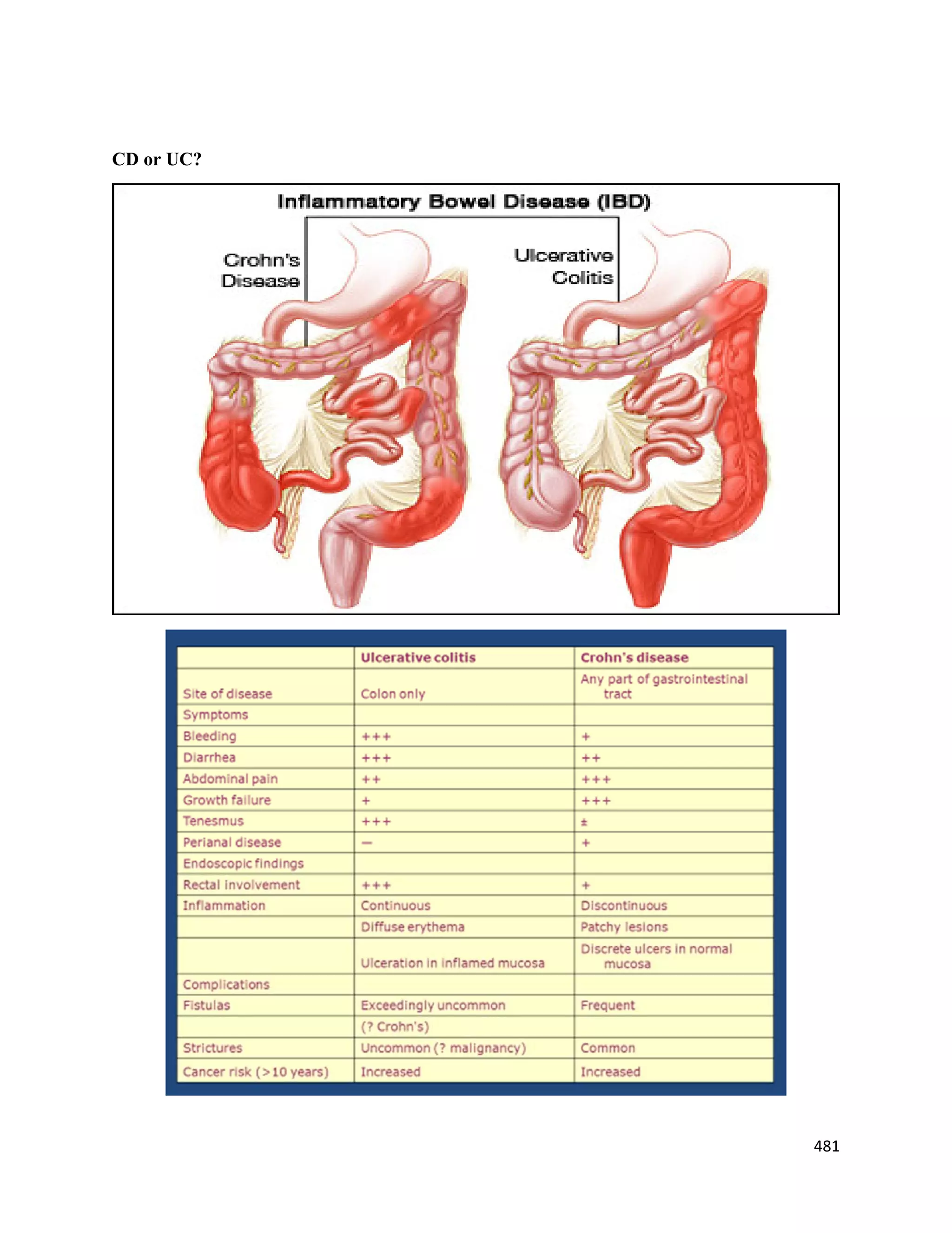 Lecture 17 Colon Disorders - Pathology | PDF