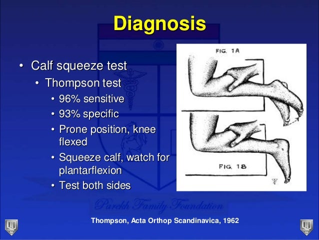 Lecture 17 parekh achilles tears