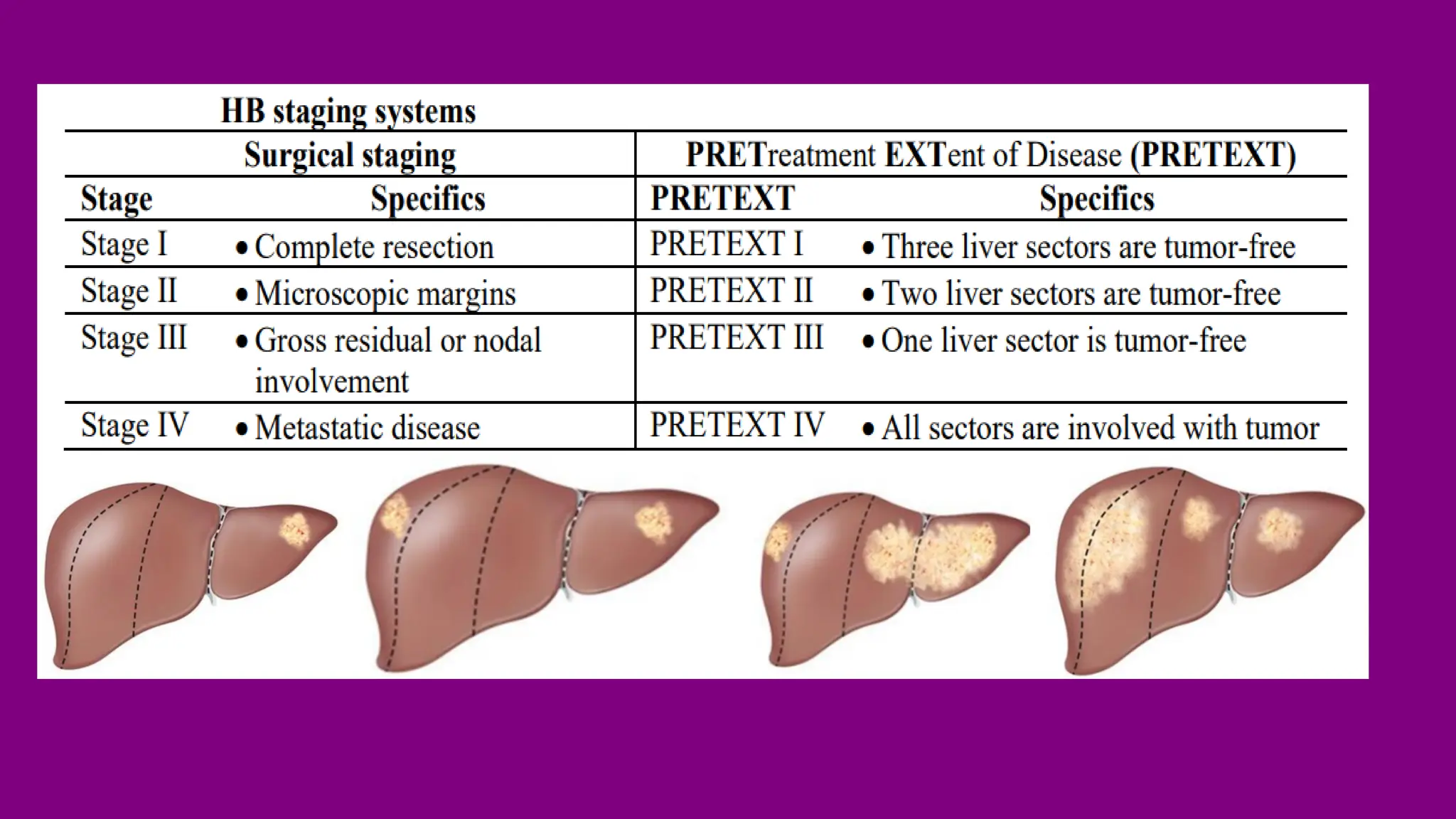 Hepatoblastoma-HB.pdf