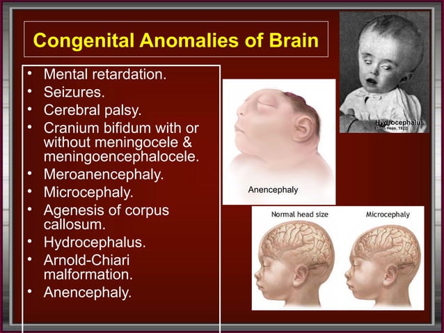 Lecture 19- Development of cerebrum & cerebellum 2013.ppt