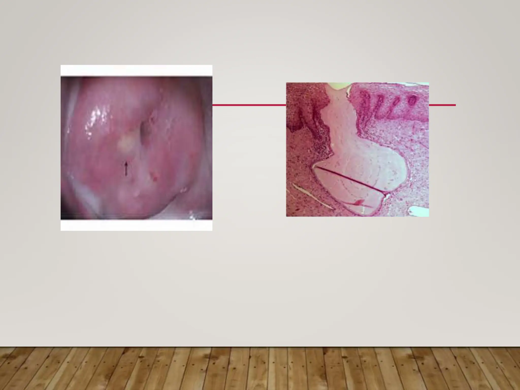 lecture 1 Clinical anatomy of the reproductive tract ,vulvovaginitis.pptx