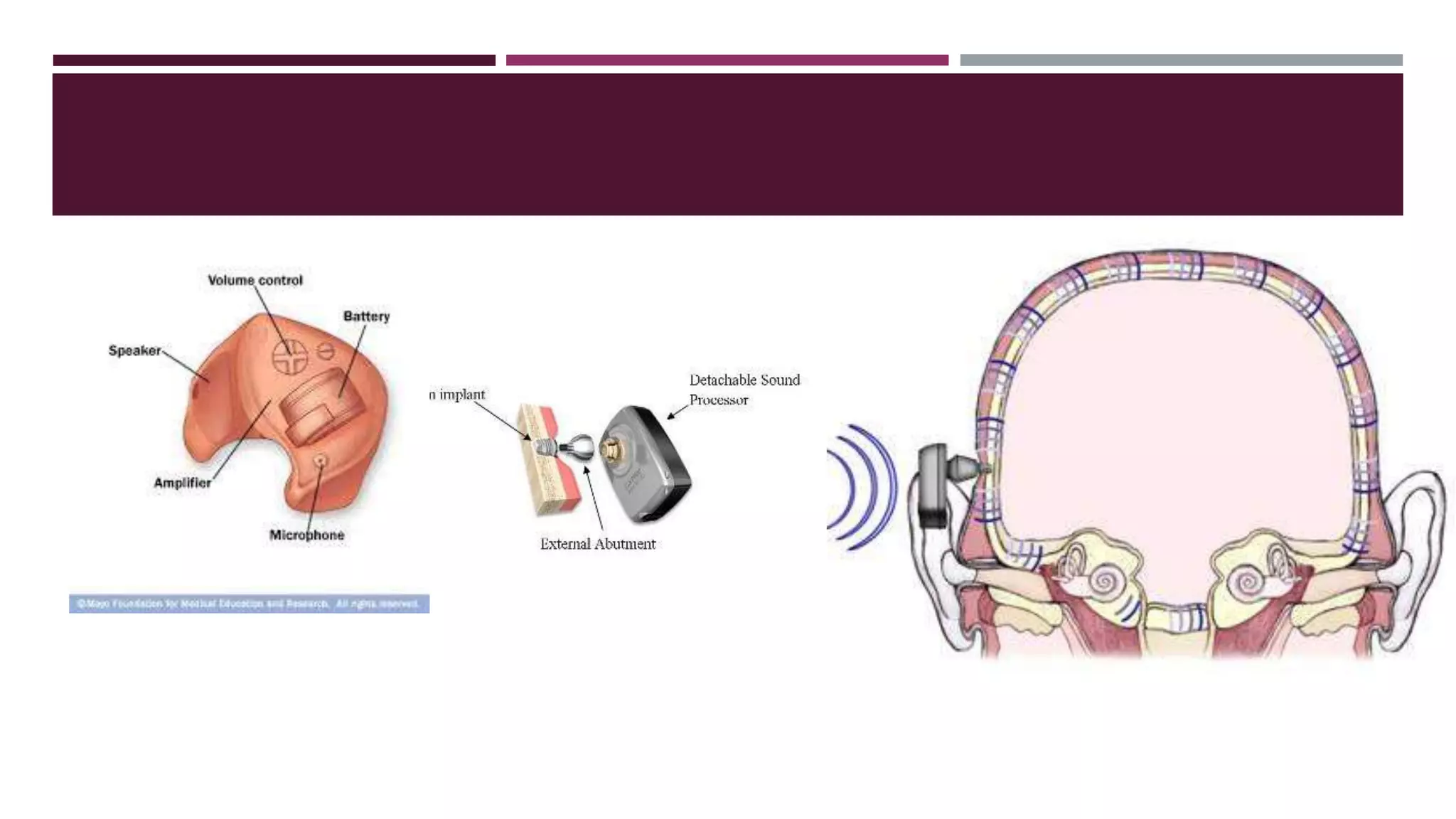 Lecture 1 c principles of amplification | PPT
