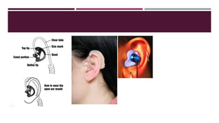 Lecture 1 c principles of amplification | PPT