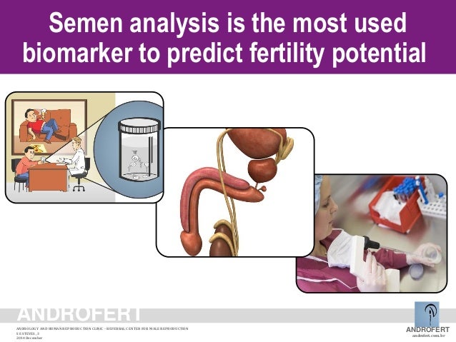 Interpreting Semen Analysis Results