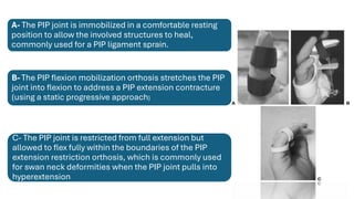lecture 1 introduction... Ortho lecture 1 | PDF