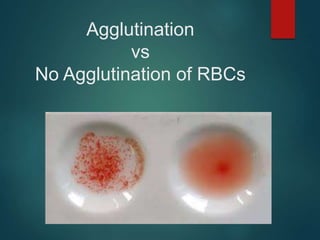 LECTURE 1 Plasma and Blood cells- Biology Lecture | PPT