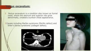 Lecture 1 Thorax osteology and ribs and muscles.pdf