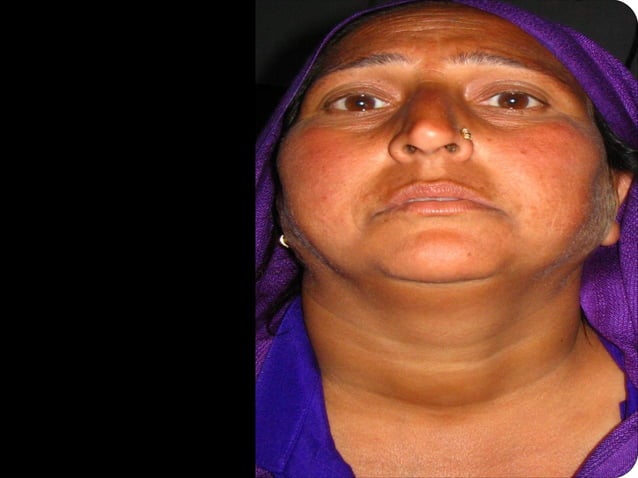 Lecture 1 Evaluation Of Thyroid Nodule Pptx