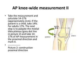 Lecture 1;TRANSTIBIA PROSTHETICS-1.ppt