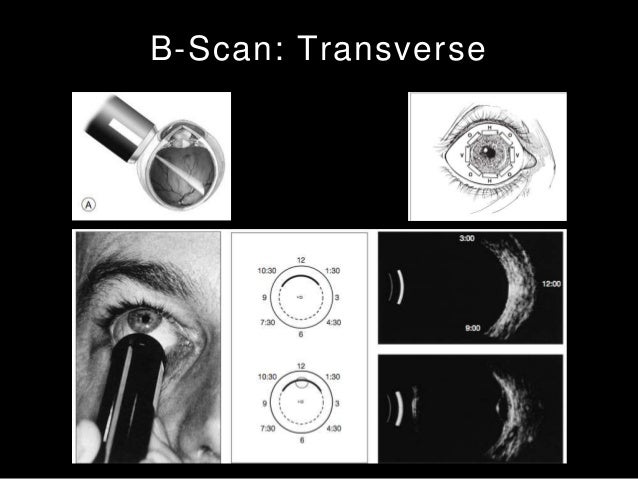 Lecture 2:Retinal Diagnostics