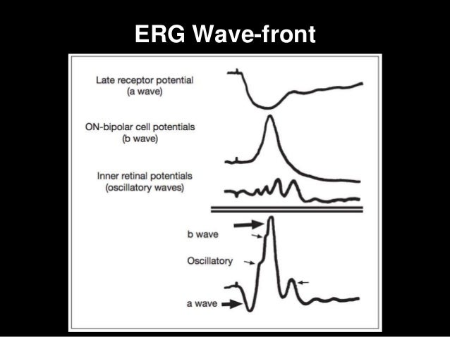 Lecture 2:Retinal Diagnostics