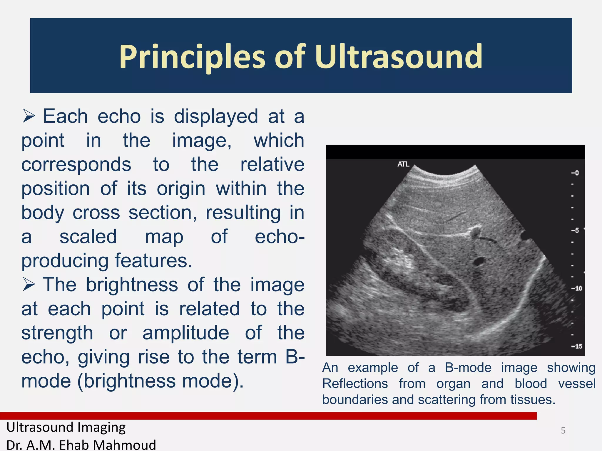 Medical Equipment Ultrasound Lecture 2 | PDF