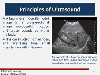 Medical Equipment Ultrasound Lecture 2 | PDF