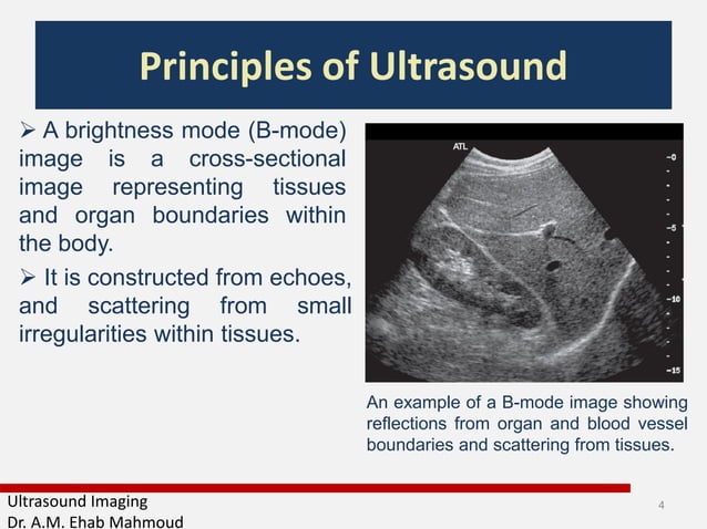 Medical Equipment Ultrasound Lecture 2 | PPT