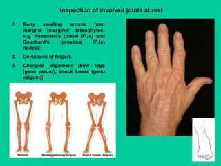 Degenerative Joint Disorder Syndrome Lecture 2 | PPT