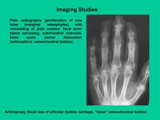 Degenerative Joint Disorder Syndrome Lecture 2 | PPT