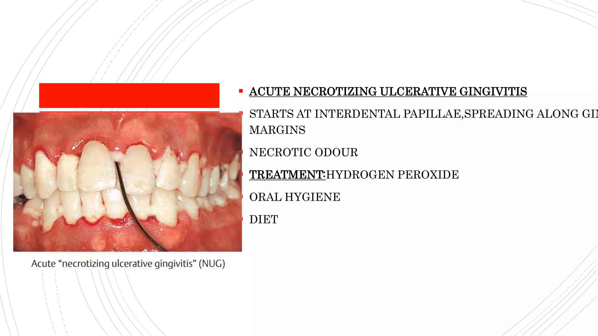 GINGIVA IN CHILDREN | PPTX