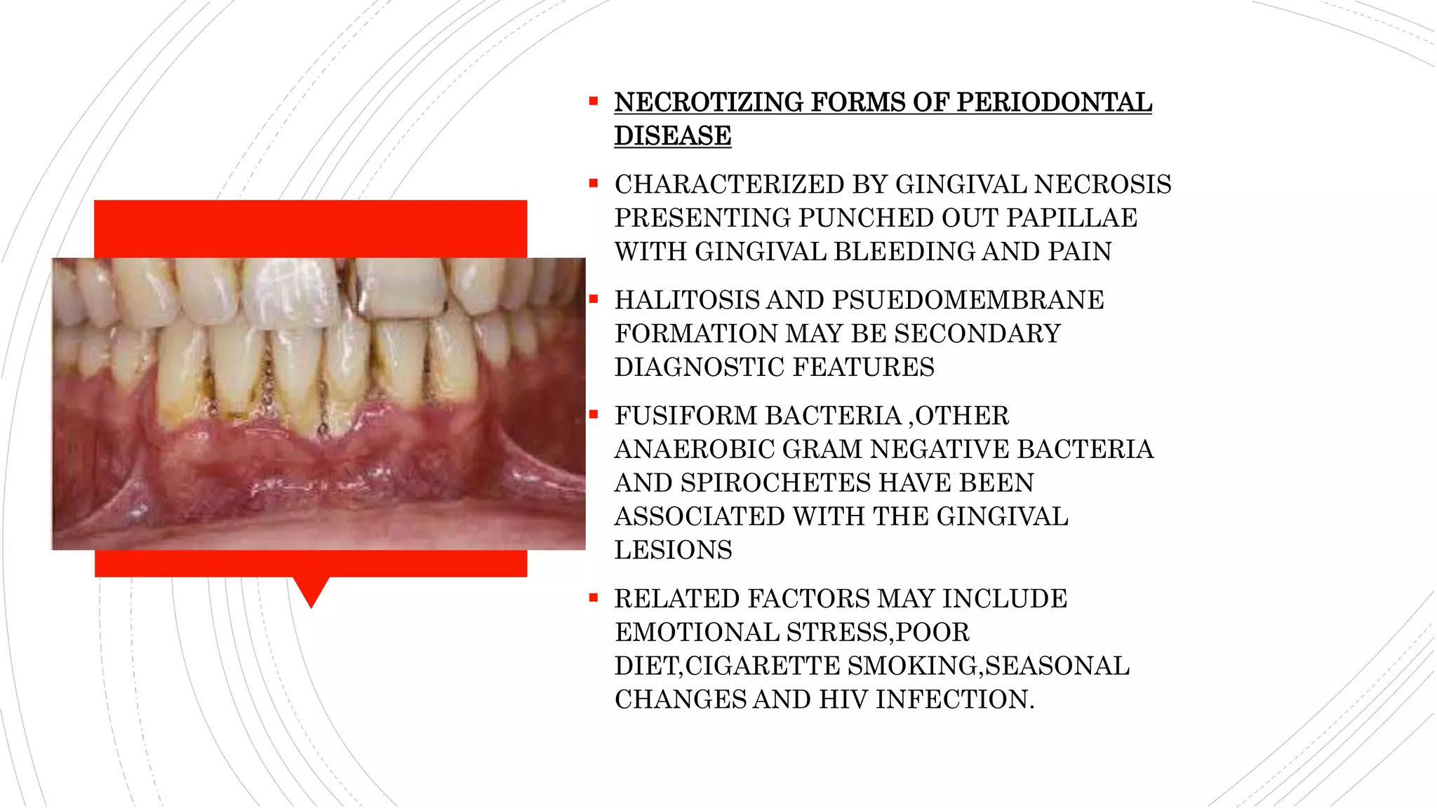 GINGIVA IN CHILDREN | PPTX