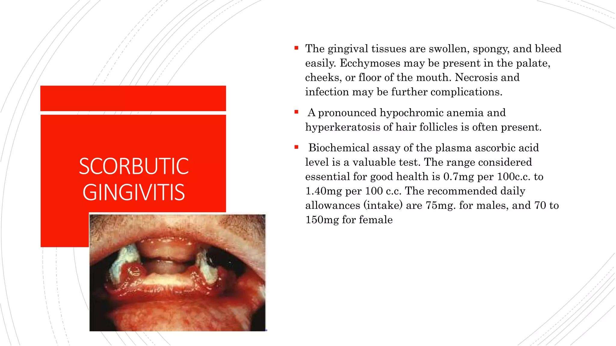 GINGIVA IN CHILDREN | PPTX