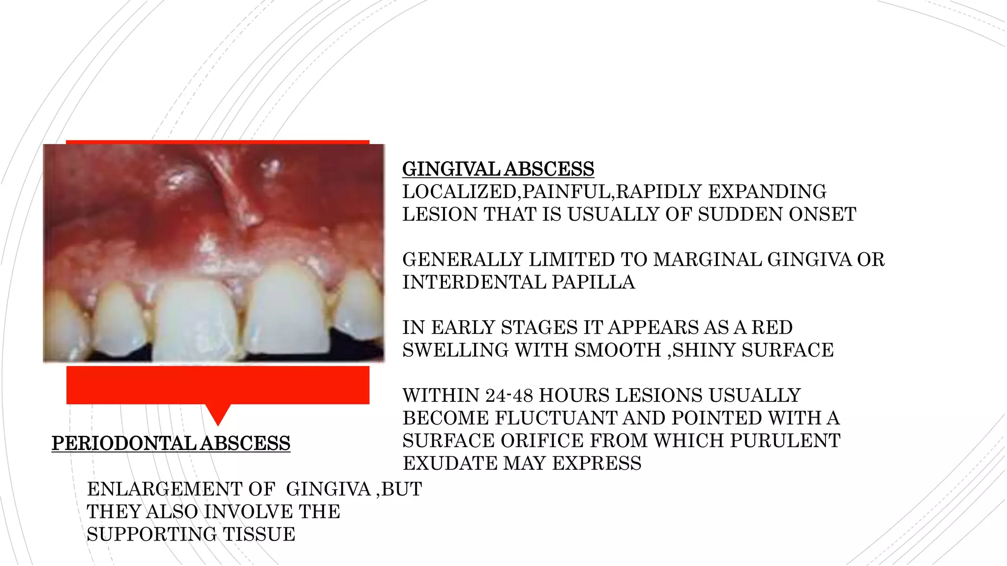 GINGIVA IN CHILDREN | PPTX