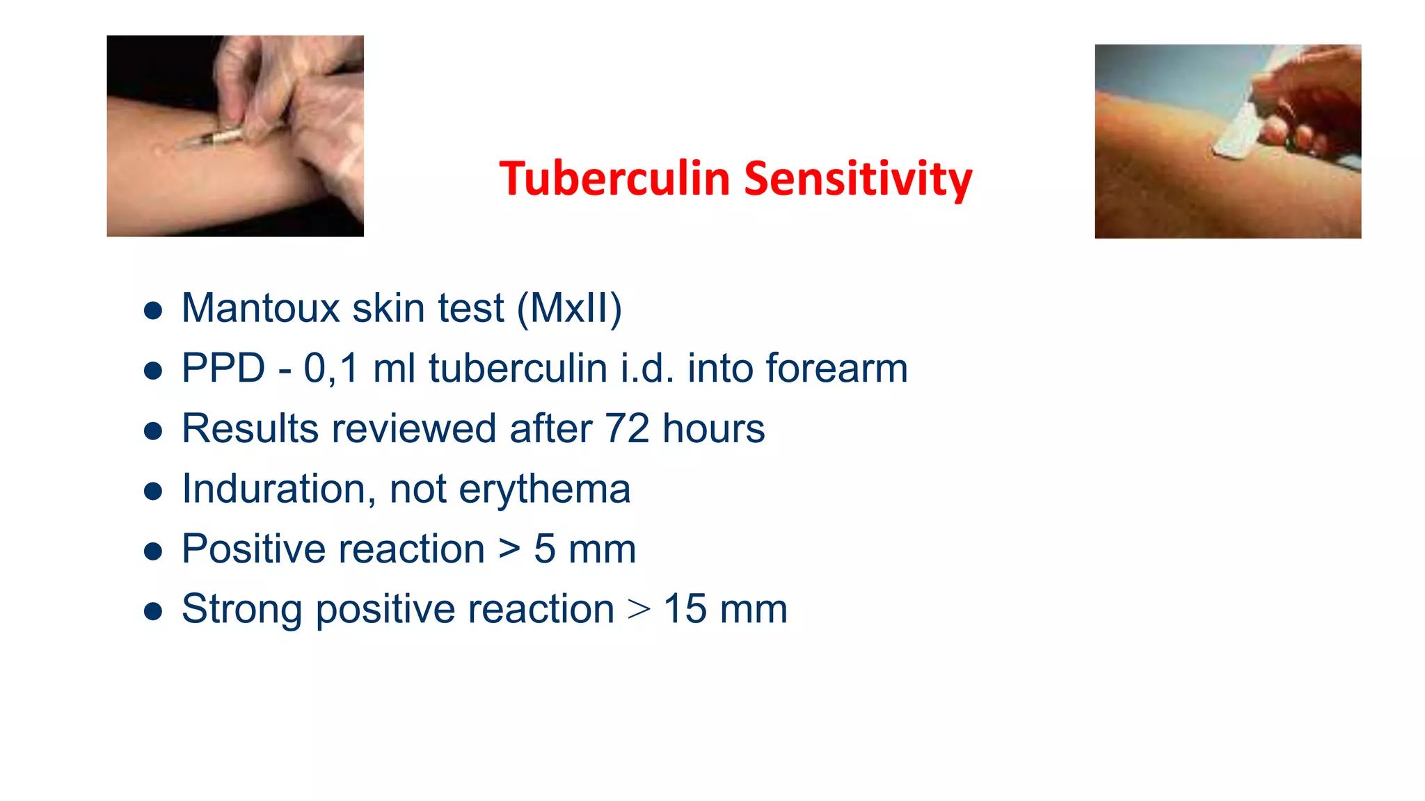 Lecture 2. Primary TB.pptx