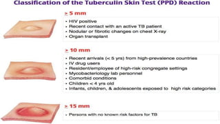 Lecture 2. Primary TB.pptx