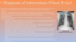 Organization of detection and diagnostics of tuberculosis | PPTX