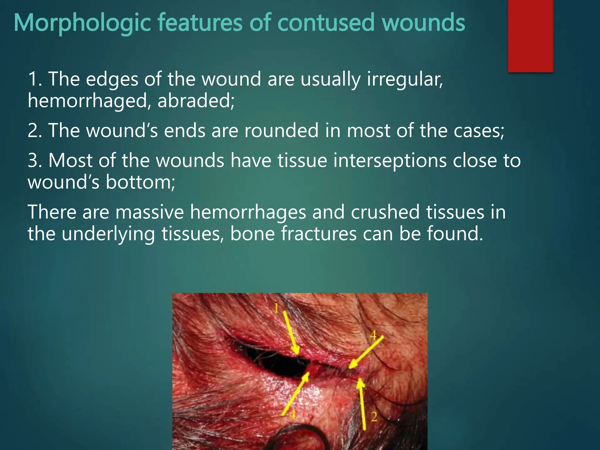 Lecture 2. Forensic traumatology.ppt