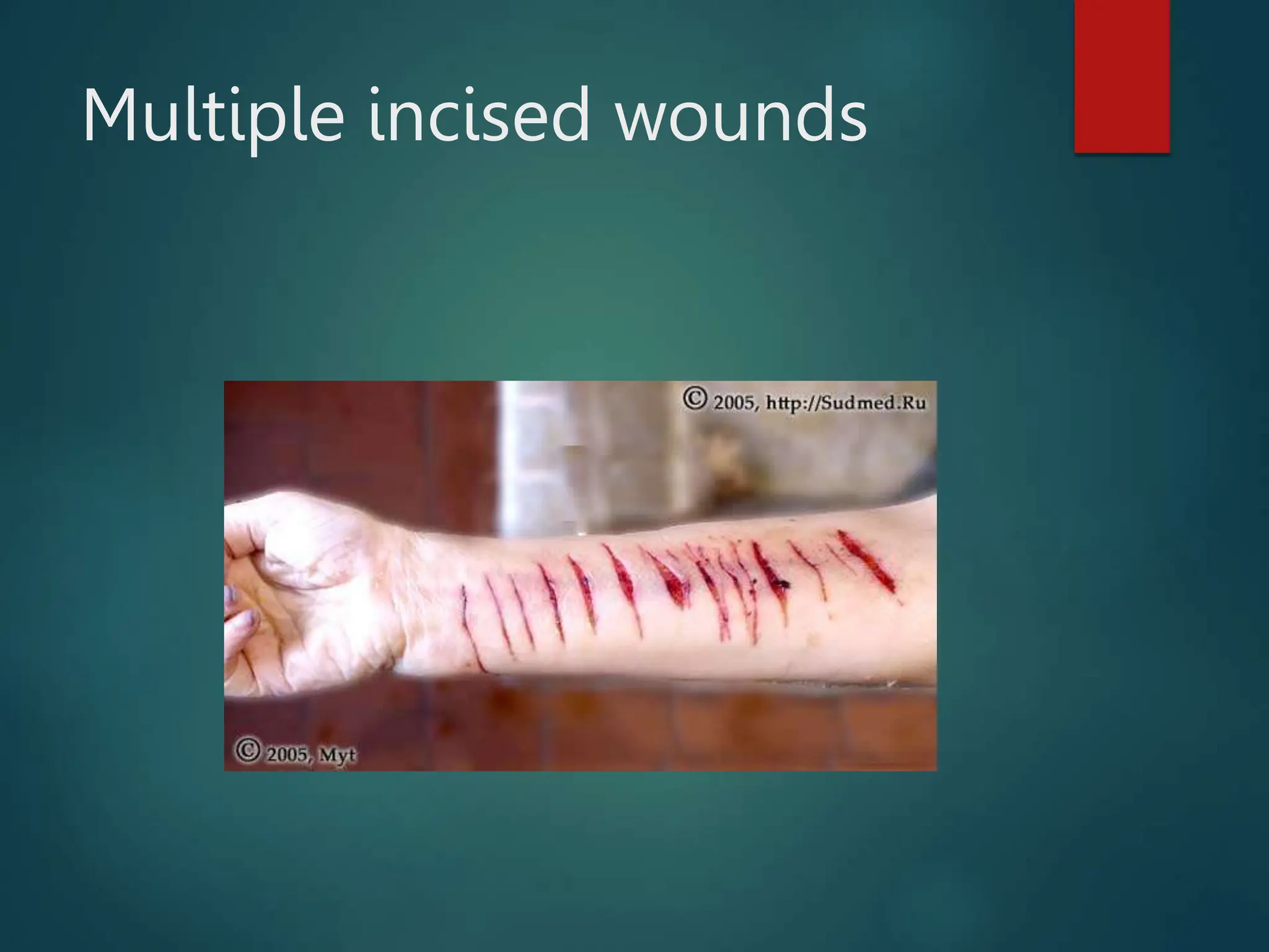 Lecture 2. Forensic traumatology.ppt