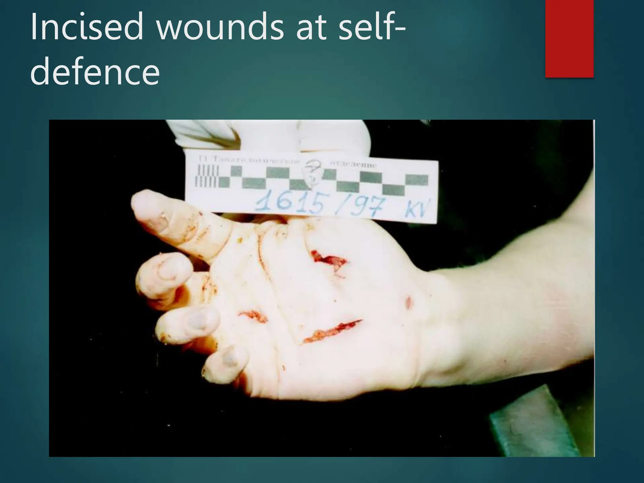 Lecture 2. Forensic traumatology.ppt