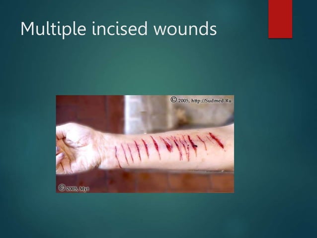 Lecture 2. Forensic traumatology.ppt