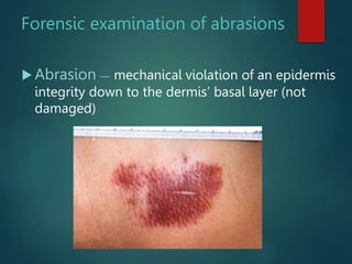 Lecture 2. Forensic traumatology.ppt