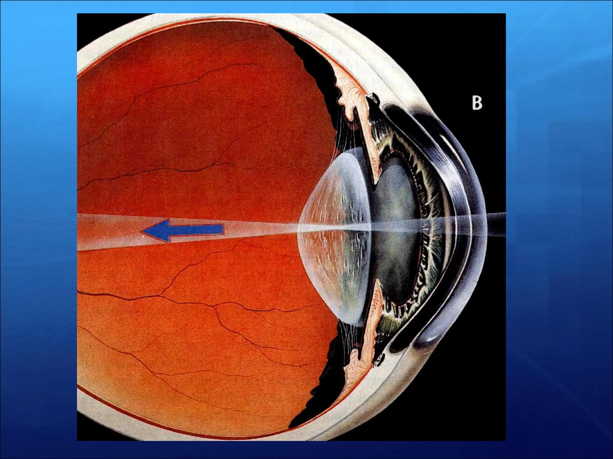 Lecture 2- Anatomy and physiology of eye.pdf