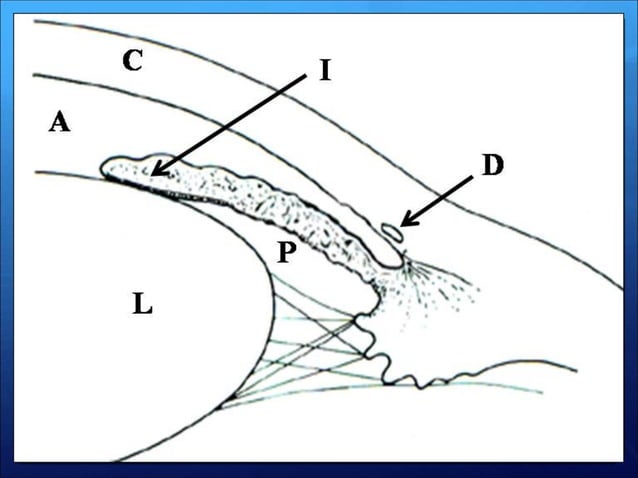 Lecture 2- Anatomy and physiology of eye.pdf