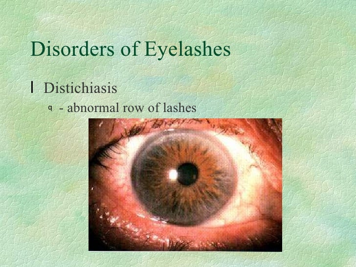 Lecture2 eyelid,orbit,lacrimal