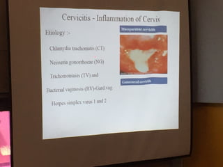 Lecture #2 - Genital Tract Infections.pdf