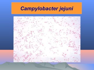 Lecture 20 Campylocbacter and Helicobacter | PPT