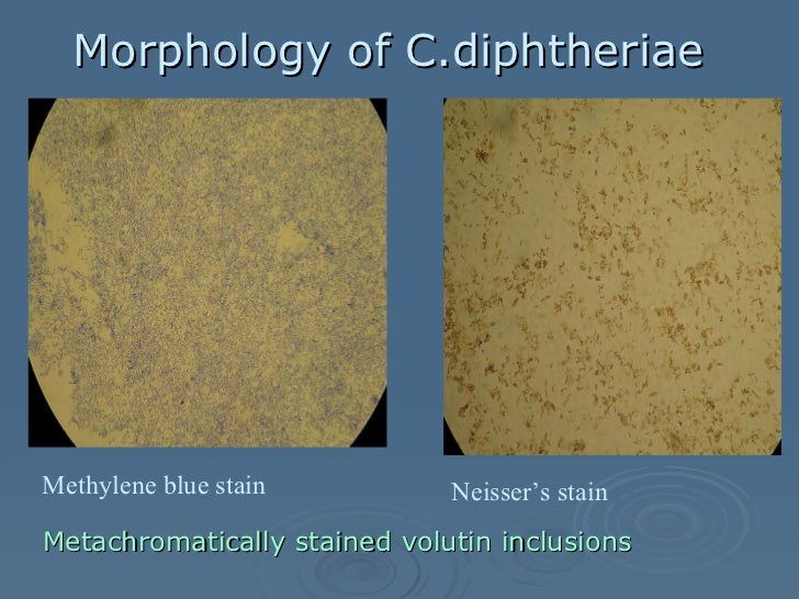 Bohomolets Microbiology Lecture #20 Bohomolets Microbiology Lecture #20