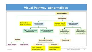 Lecture 5/2022 Special senses -Vision 5 -Physiology of vision - Visual ...