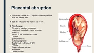 Lecture 20 Antepartum Hemorrhage .pptx