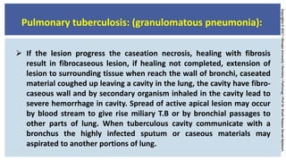 Lecture 20 diseases of respiratory system | PPT