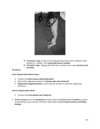 Lecture 20 disorders of hypothalamus, pituitary and thyroid glands ...