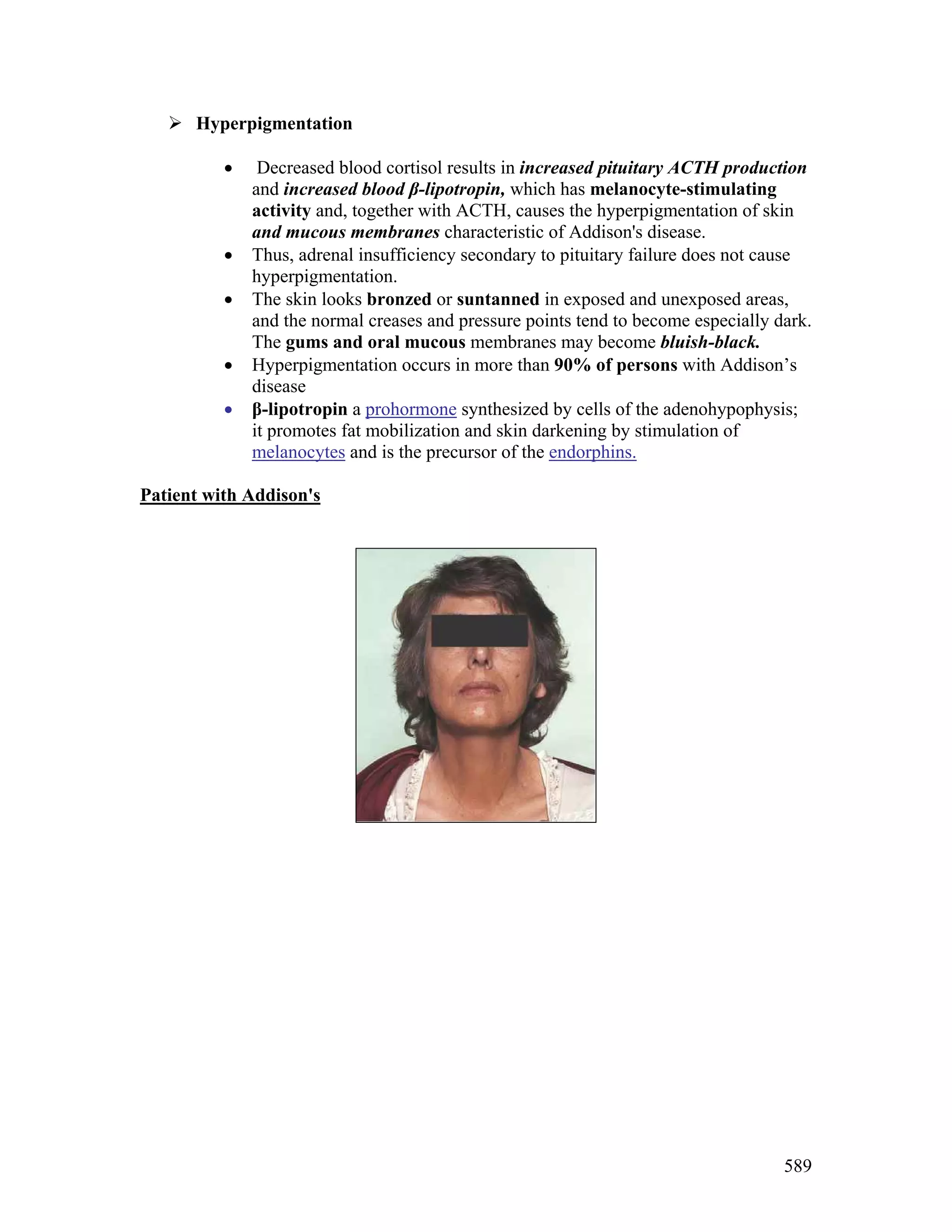 Lecture 21 adrenal glands diseases - pathology | PDF