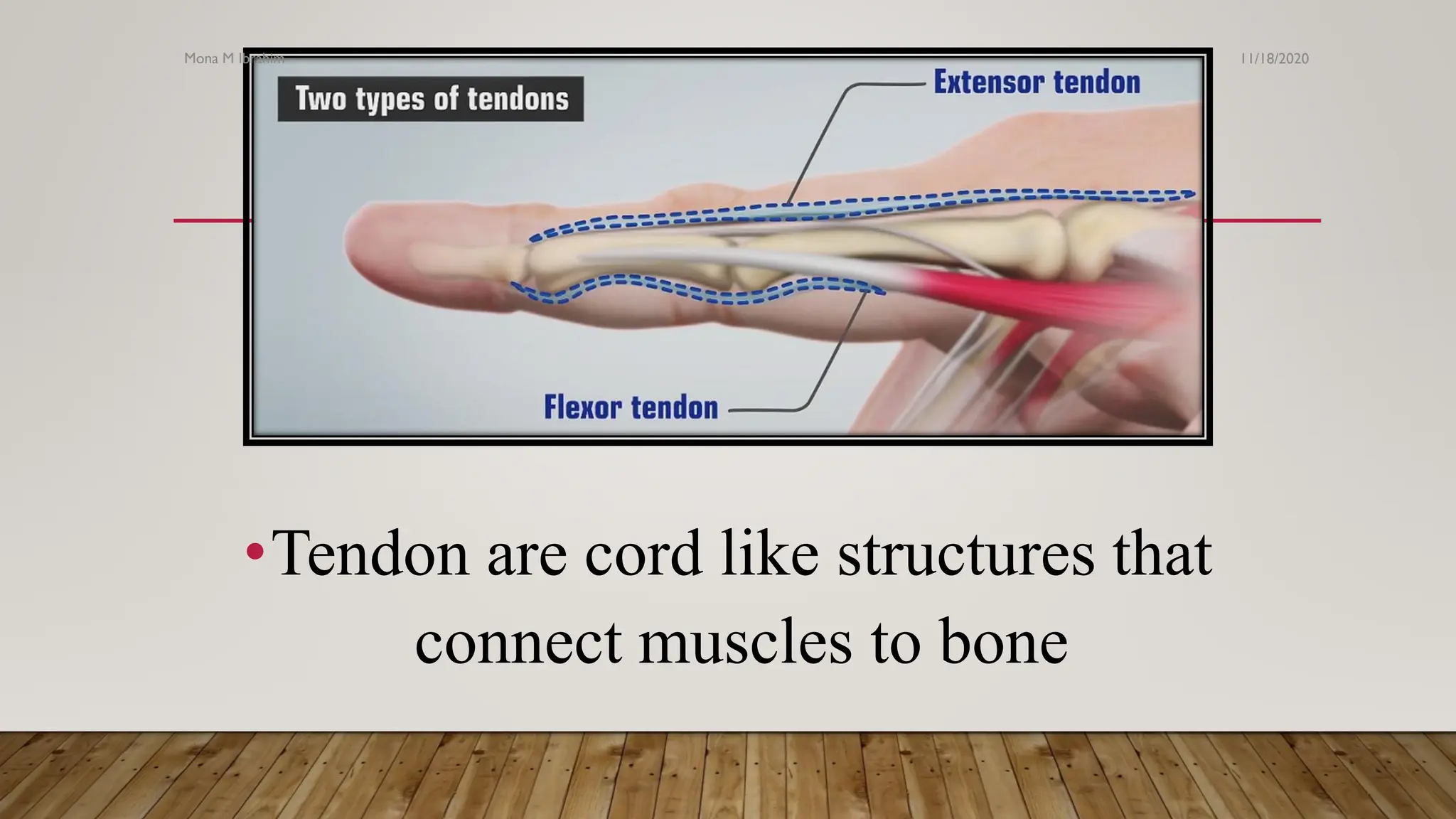 lecture 21(Extensor Tendon Injuries) .pdf