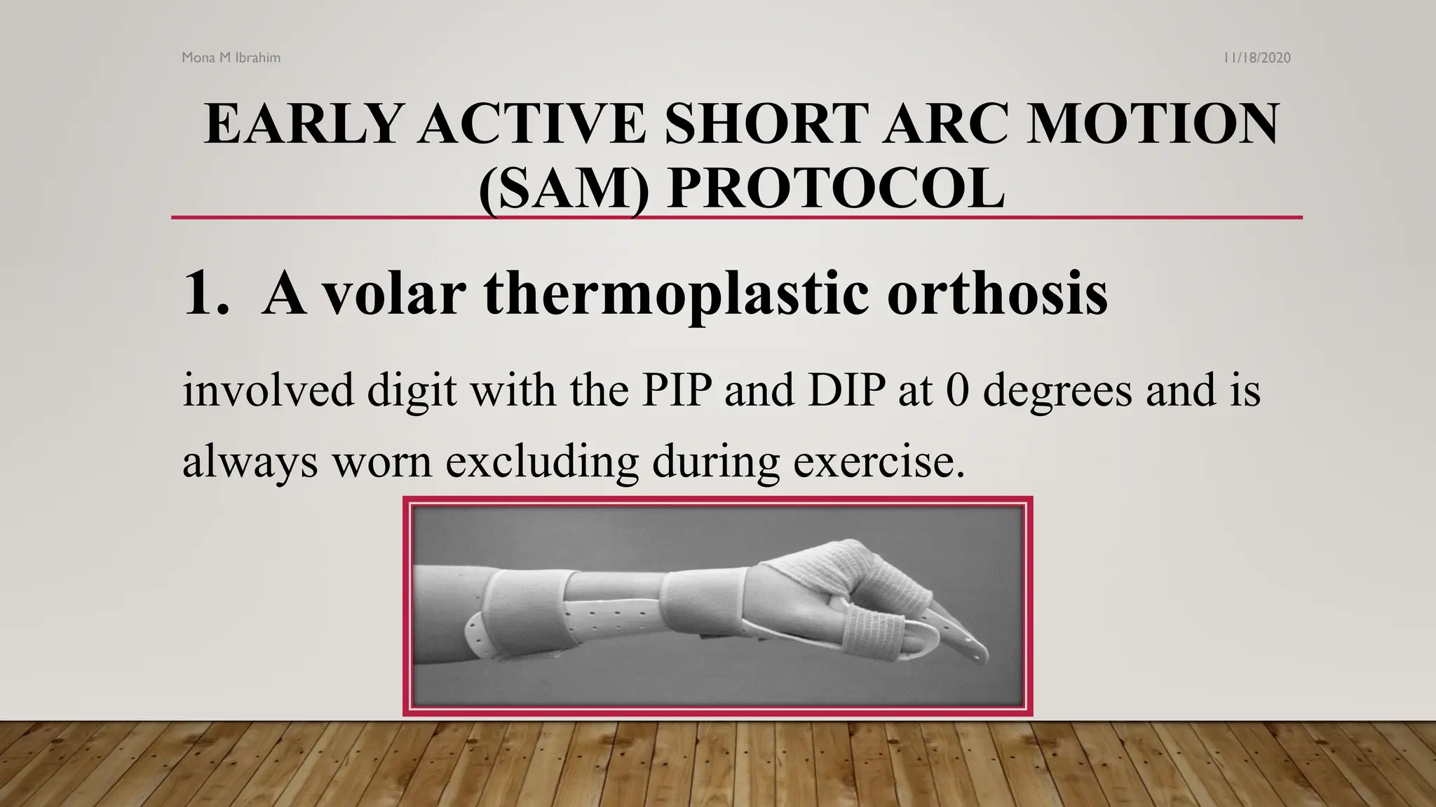 lecture 21(Extensor Tendon Injuries) .pdf