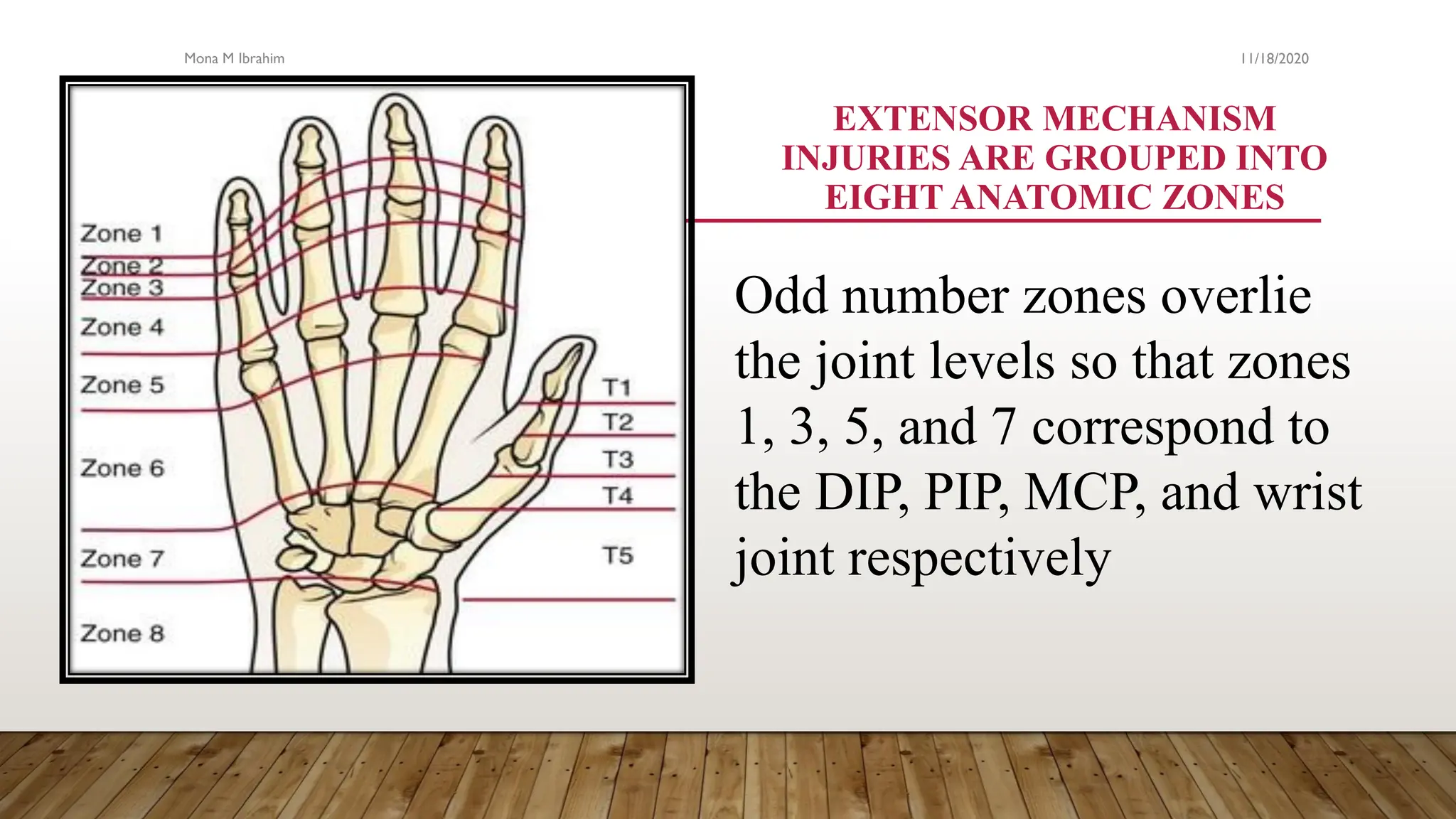 lecture 21(Extensor Tendon Injuries) .pdf