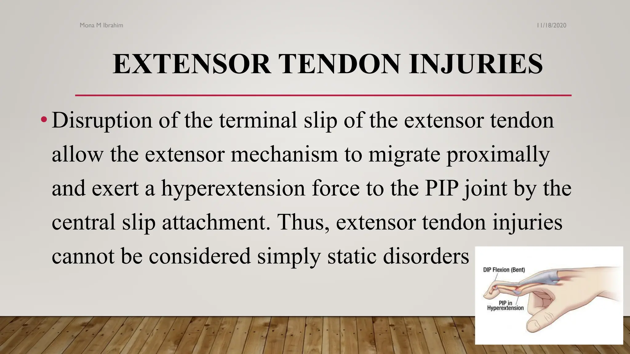 lecture 21(Extensor Tendon Injuries) .pdf