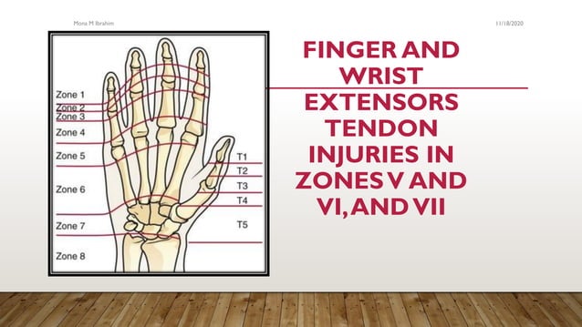 lecture 21(Extensor Tendon Injuries) .pdf